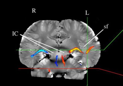 New Technique Reveals Dolphin Brain Pathways - The Whale Sanctuary ...